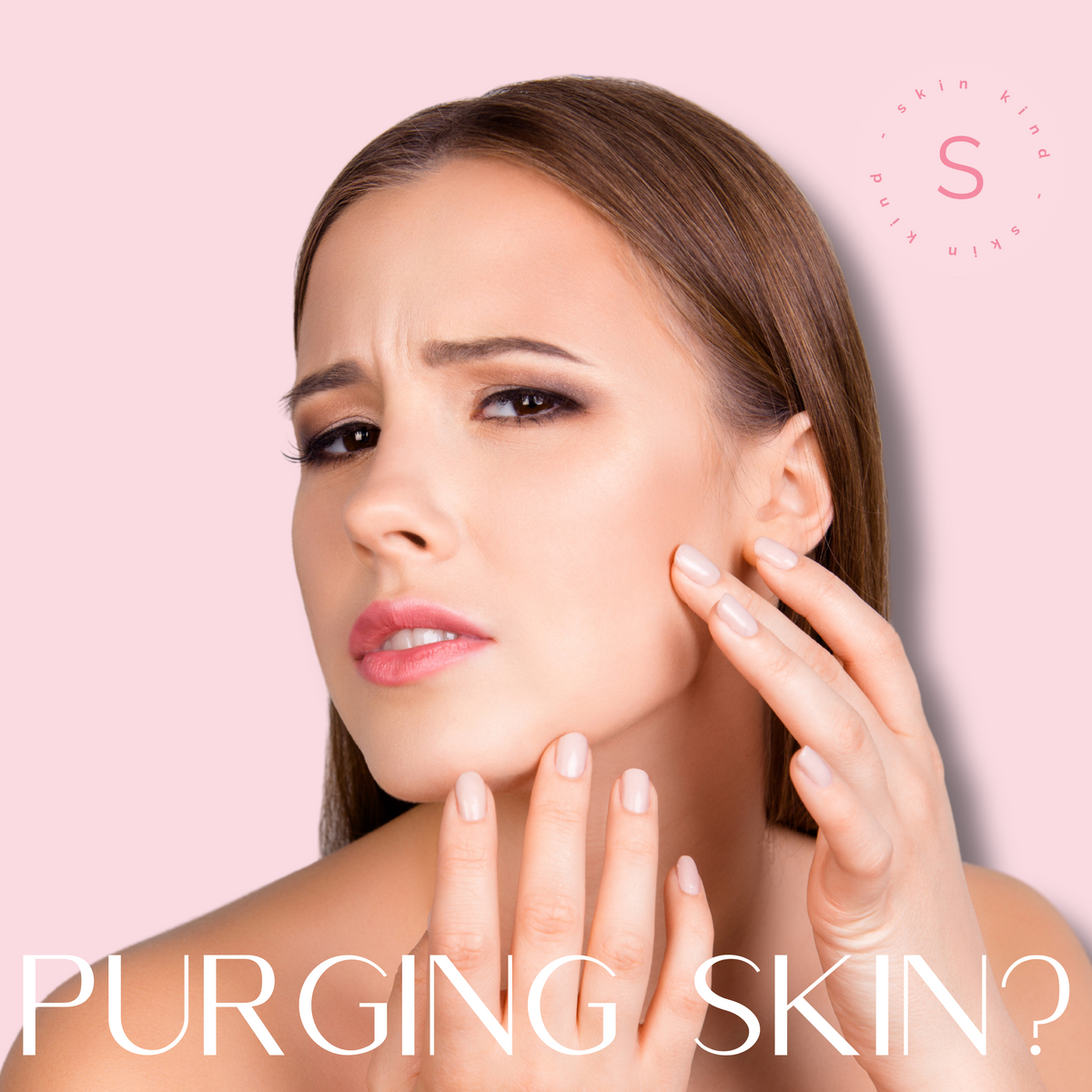 From Breakouts to Breakthroughs: Understanding Skin Purging – Skin Kind ...