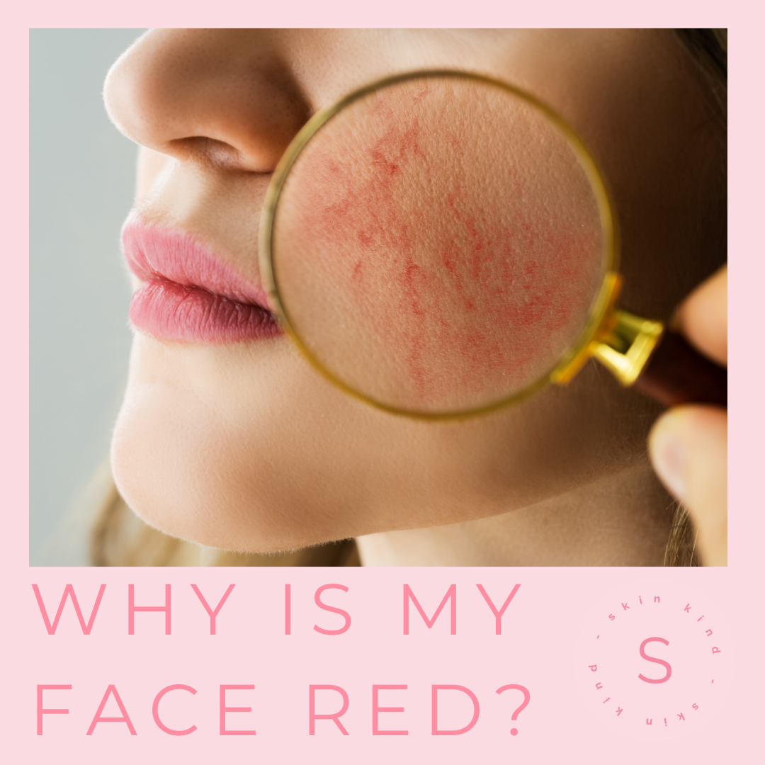 Why Is My Face Red? – Skin Kind Studio